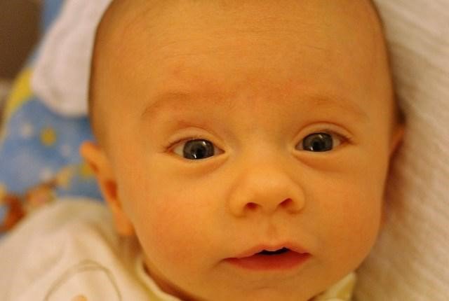 What Can Happen To A Child With G6PD Deficiency Vinmec what-can-happen-to-a-child-with-g6pd-deficiency-vinmec