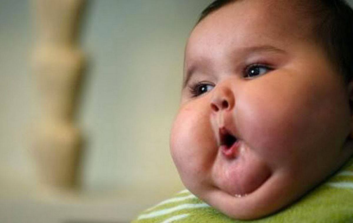 What Is Edematous Malnutrition Kwashiorkor Vinmec What Is Edematous Malnutrition Kwashiorkor Vinmec
