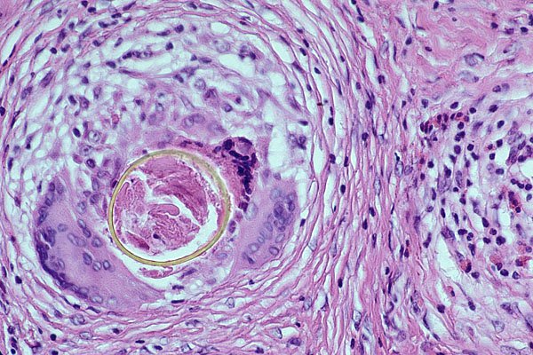 Mục đích của giải phẫu bệnh | Vinmec