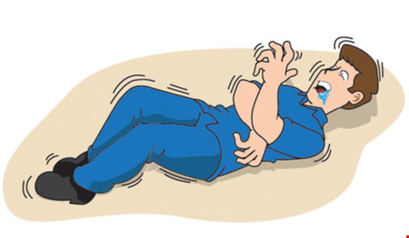 What are the types of convulsions? | Vinmec