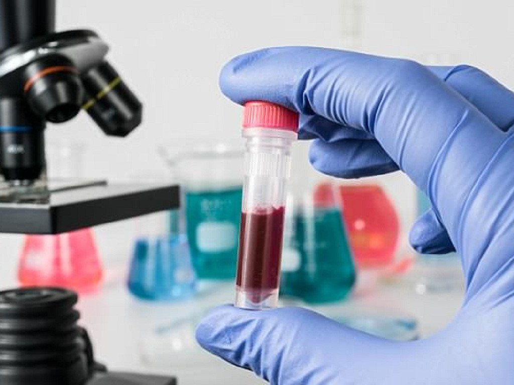 What Is The Risk Of Abnormal Blood Test Results Vinmec what-is-the-risk-of-abnormal-blood-test-results-vinmec