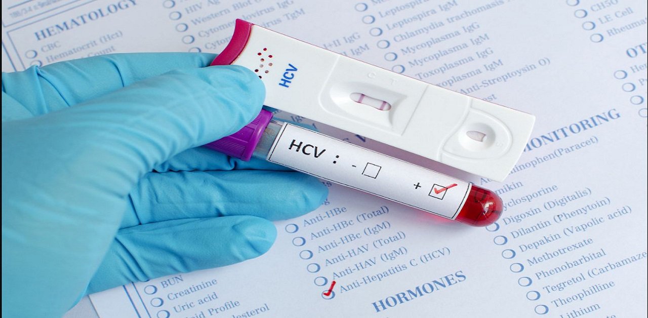 How are HCV-positive women treated? | Vinmec